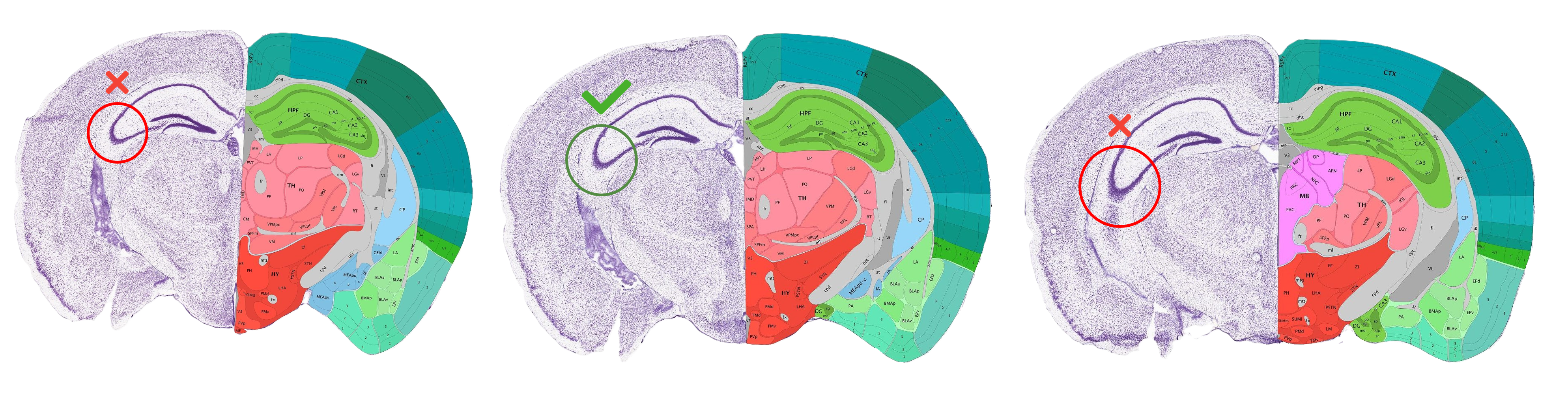 Tissue Section Selector